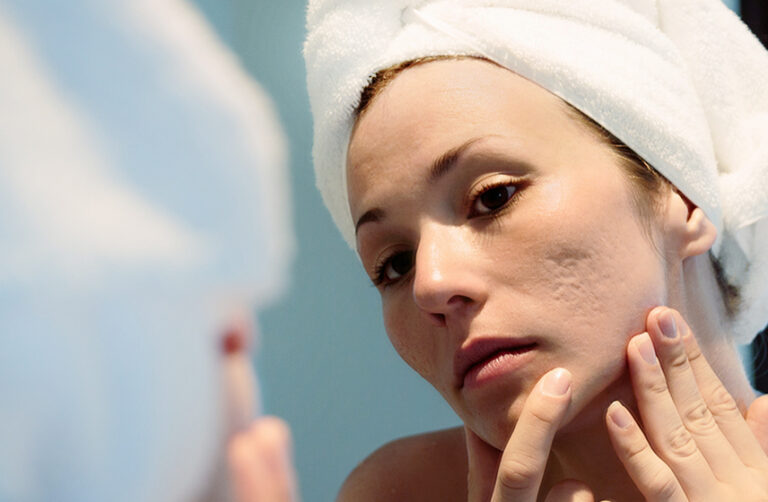 Why Scar Tissue Hurts Years Later | Pain Relief in LA